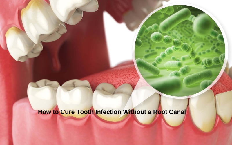 Pull Molar or Root Canal Therapy: Make the Right Choice